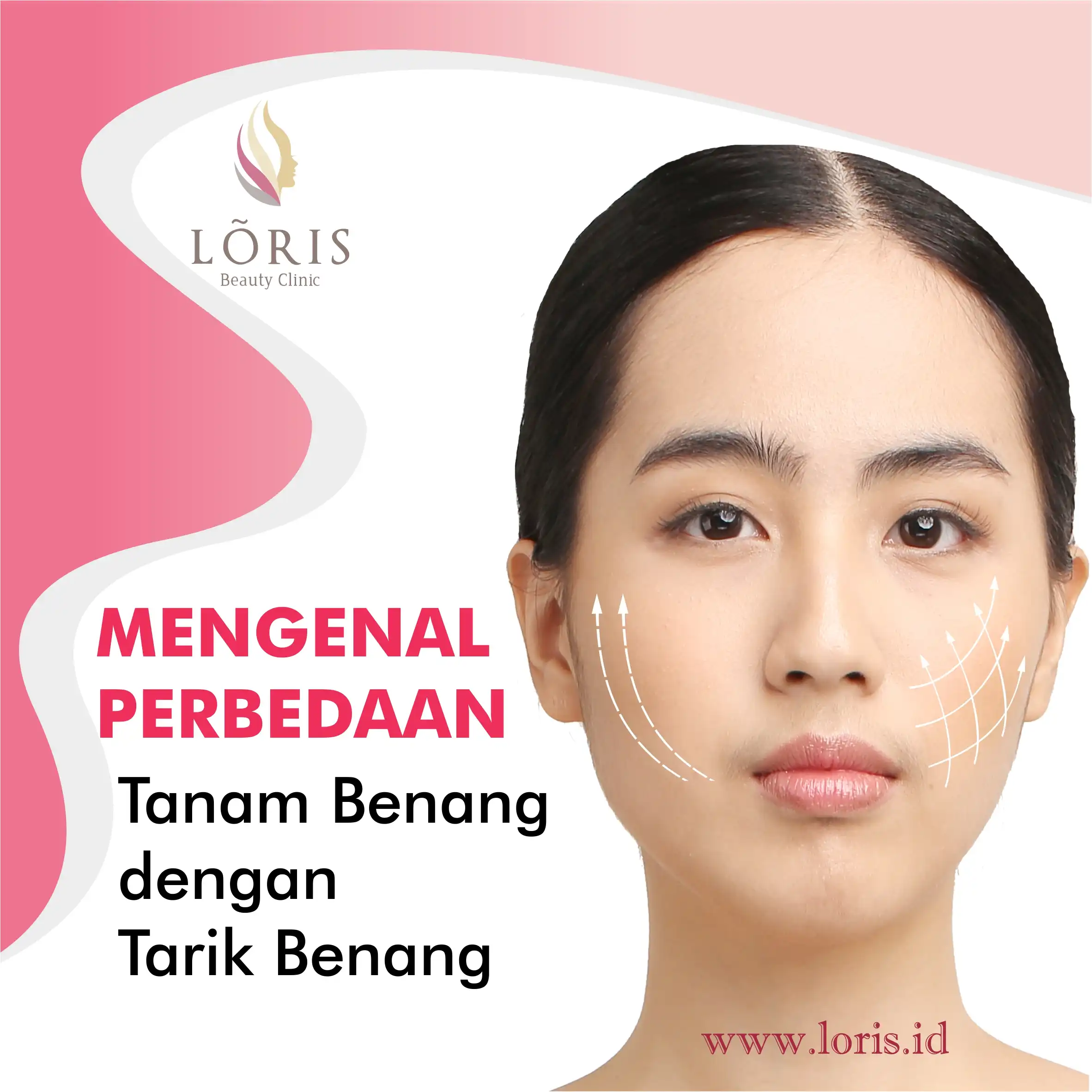 PERBEDAAN TANAM BENANG & TARIK BENANG - Loris Beauty Clinic PERBEDAAN TANAM BENANG & TARIK BENANG - Loris Beauty Clinic
